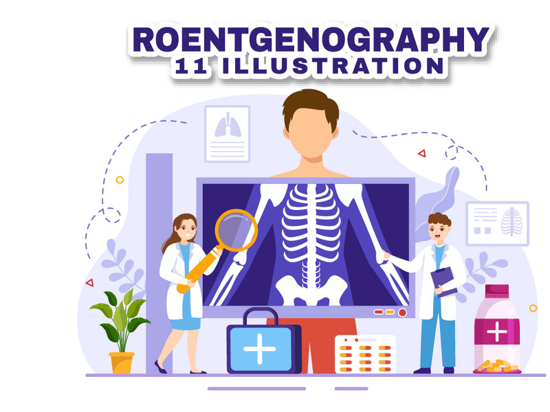 11 Roentgenography Vector Illustration by denayuneep ~ EpicPxls